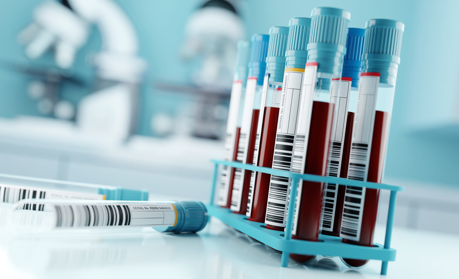 How weight loss and diet changes show up in lab results - MediaFeed